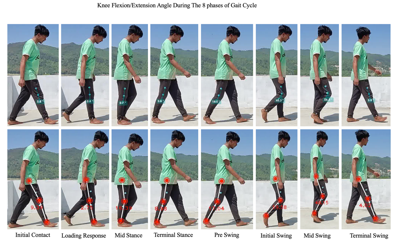 Machine Learning Application On Development Of Human Gait Analysis System For Clinical Purpose